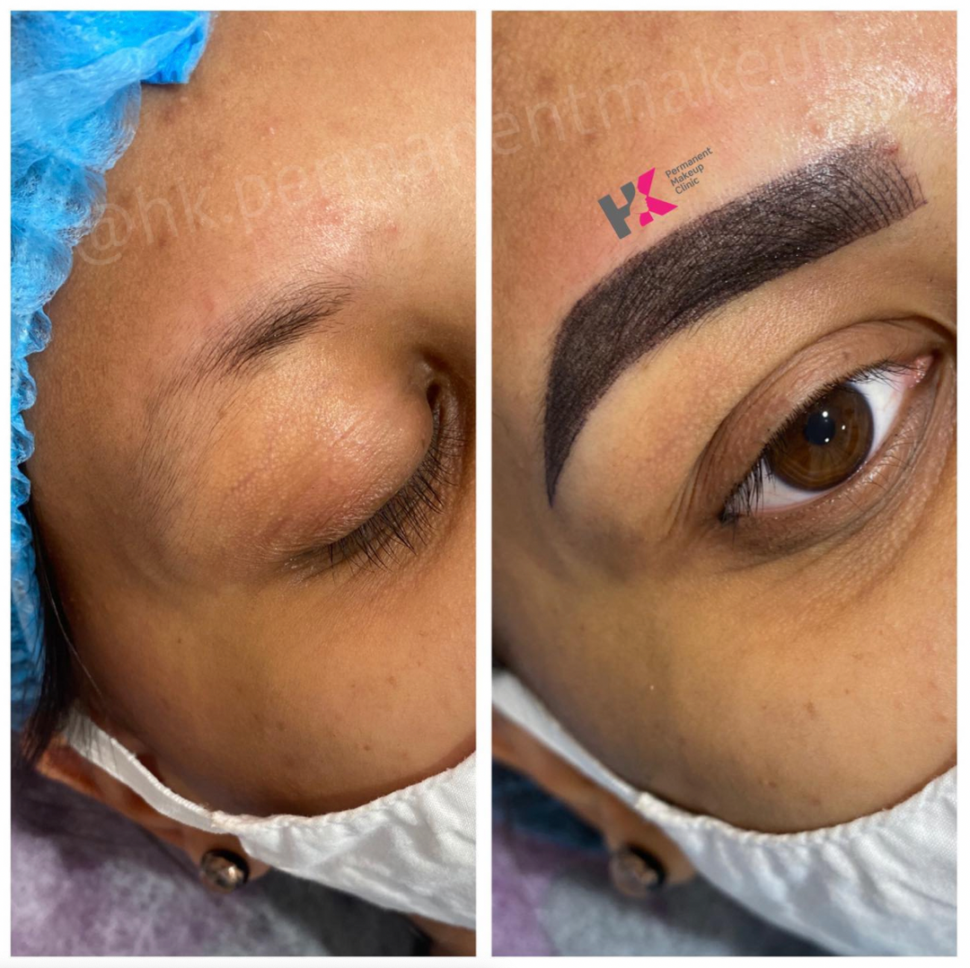 Transform Your Look with Permanent Eyebrows |Microblading – hkclinic