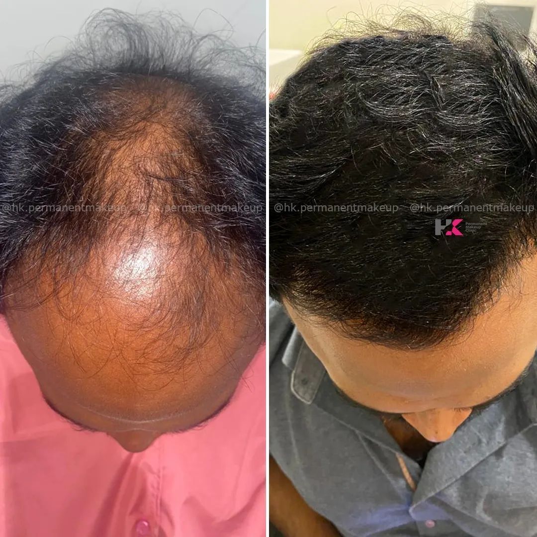 Become a Franchise Partner of HK Permanent Makeup Clinic – hkclinic